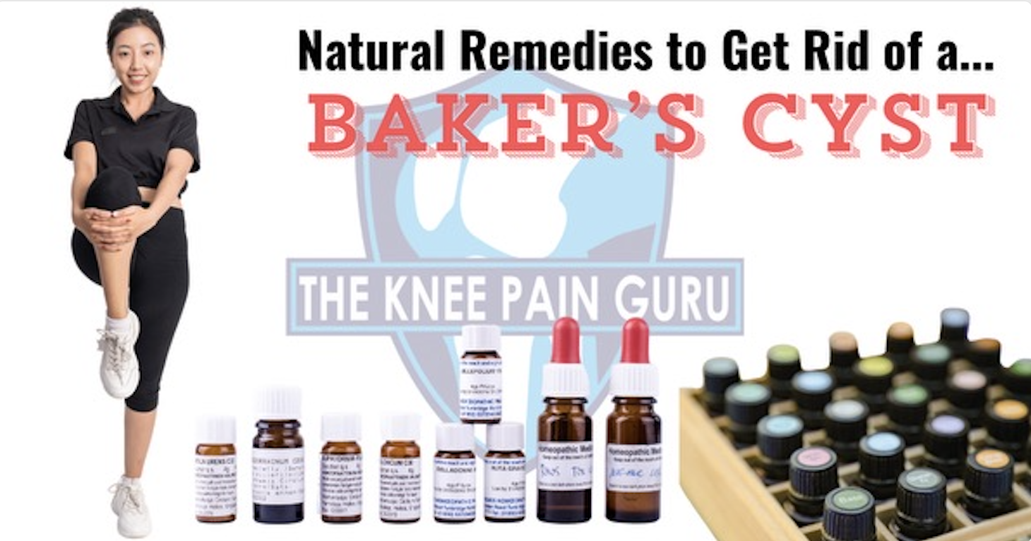 Natural Remedies to Get Rid of a Baker's Cyst - The Knee Pain Guru